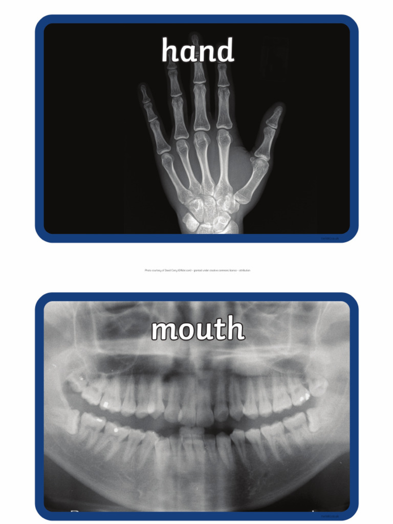 X-Ray Display Photos | PDF
