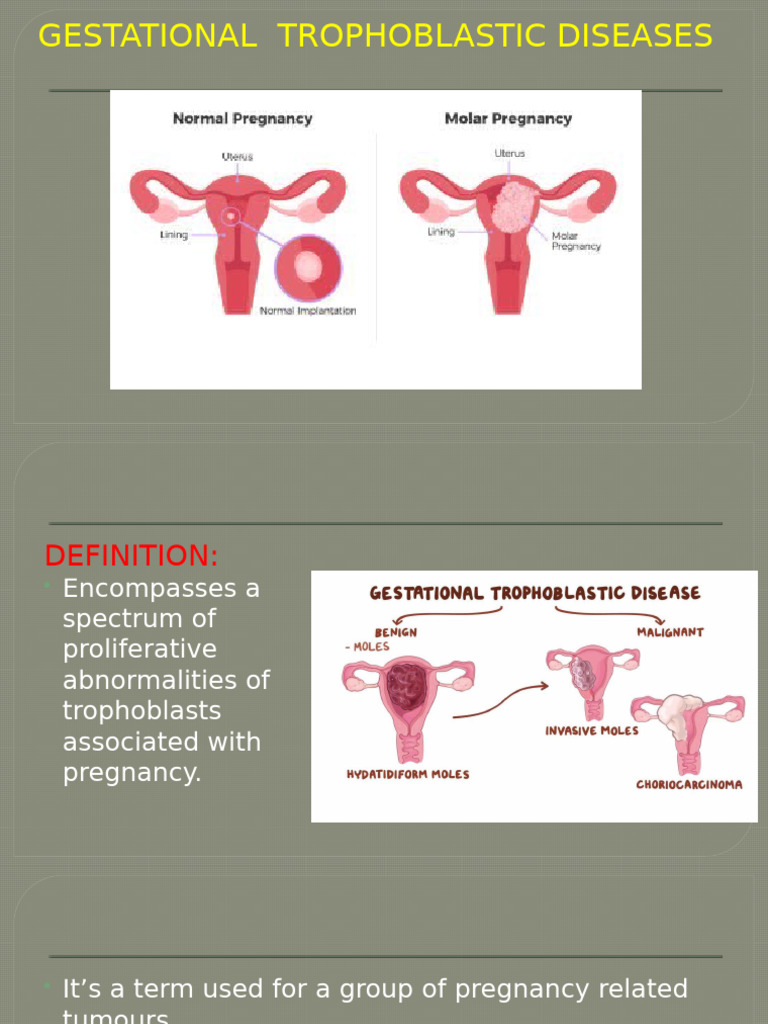 Gestational Trophoblastic Diseases | PDF