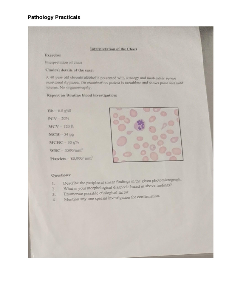Hematology Clinical Charts 1no's (1Ã - 5 5 Marks) | PDF | Anemia ...
