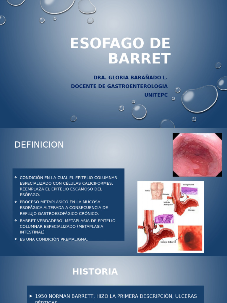 Esofago de Barret | PDF | La enfermedad por reflujo gastroesofágico ...