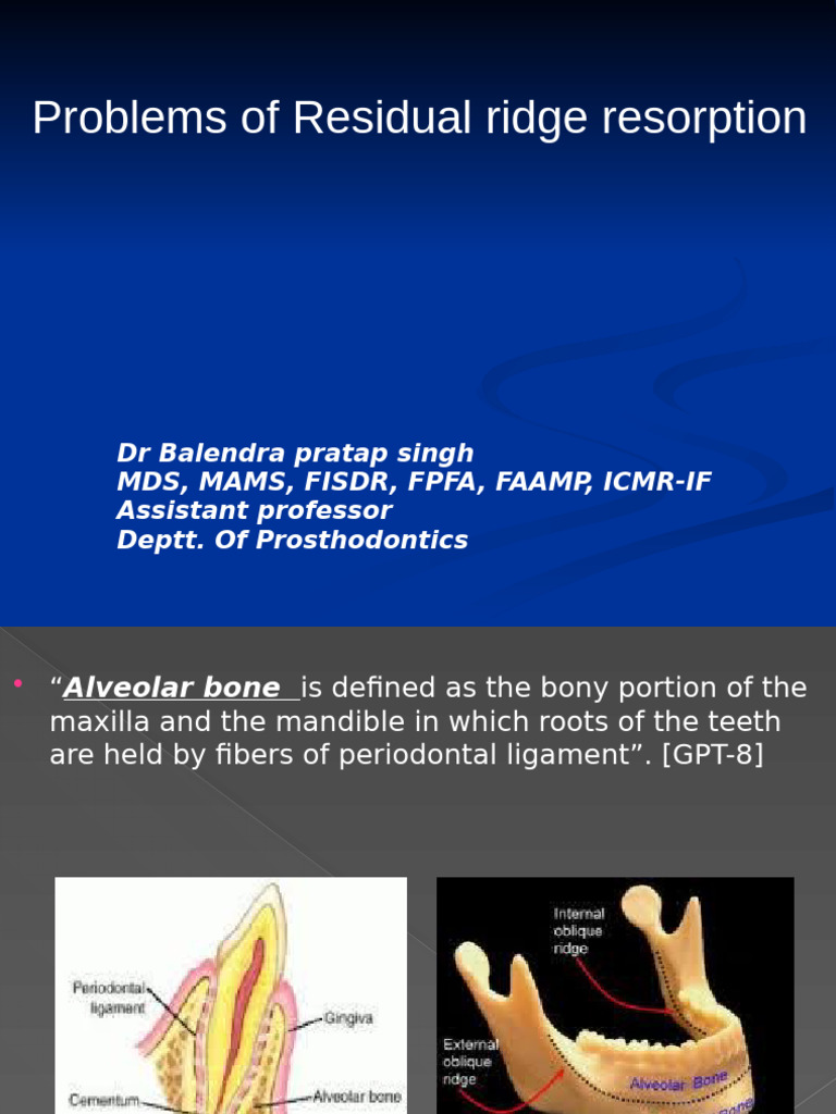 Problems of Residual Alveolar Ridge | PDF | Dentures | Bone