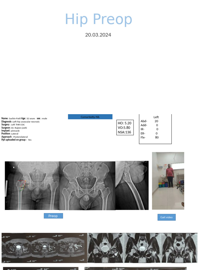 Hip Unit Preops 20.03.24.pptx New | PDF