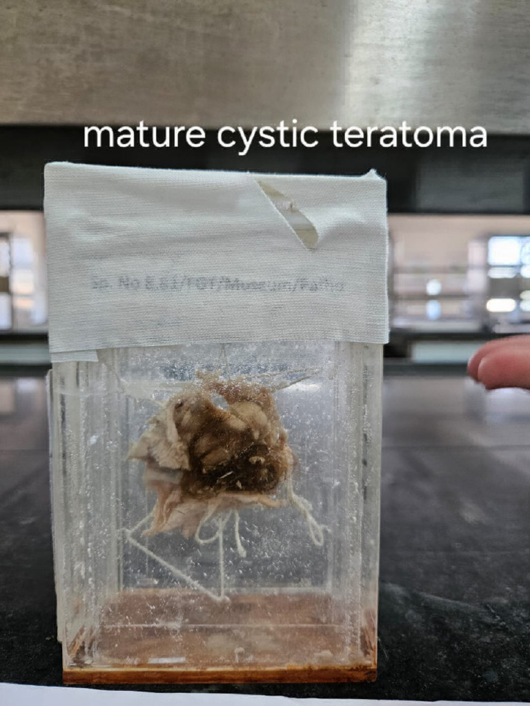 Pathology Specimen | PDF