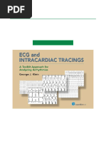 Understanding Left Bundle Branch Block | PDF | Electrocardiography ...