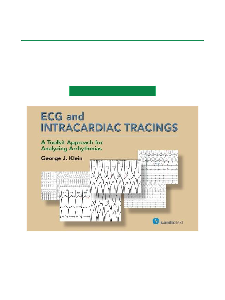 ECG and Intracardiac Tracings A Toolkit Approach For Analyzing ...