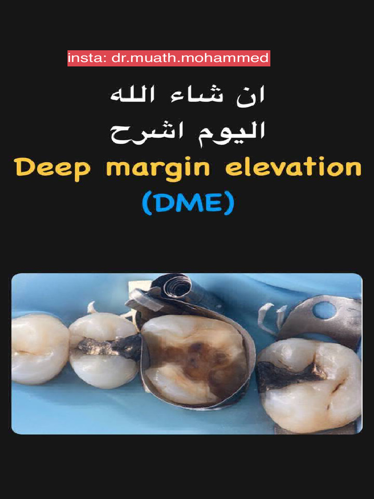 Insta: DR - Muath.mohammed | PDF
