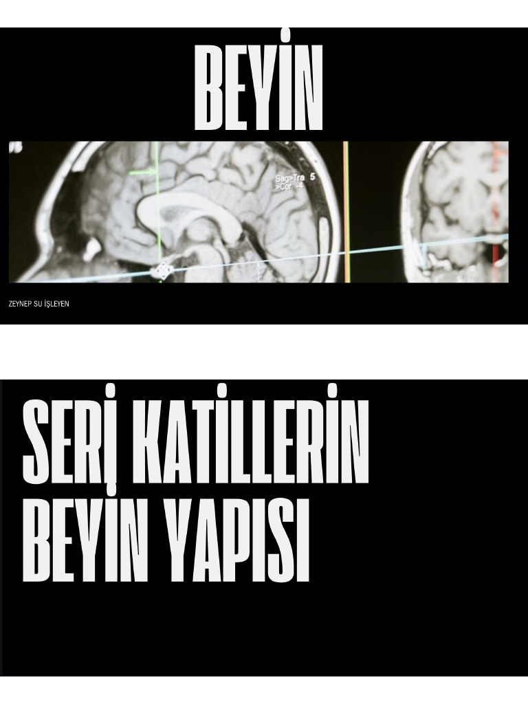 Beyin | PDF