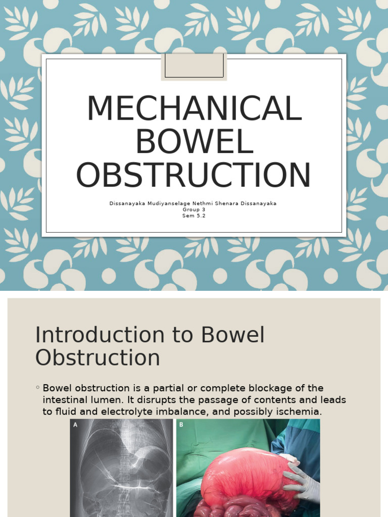 Mechanical Bowel Obstruction Detailed Presentation | PDF ...