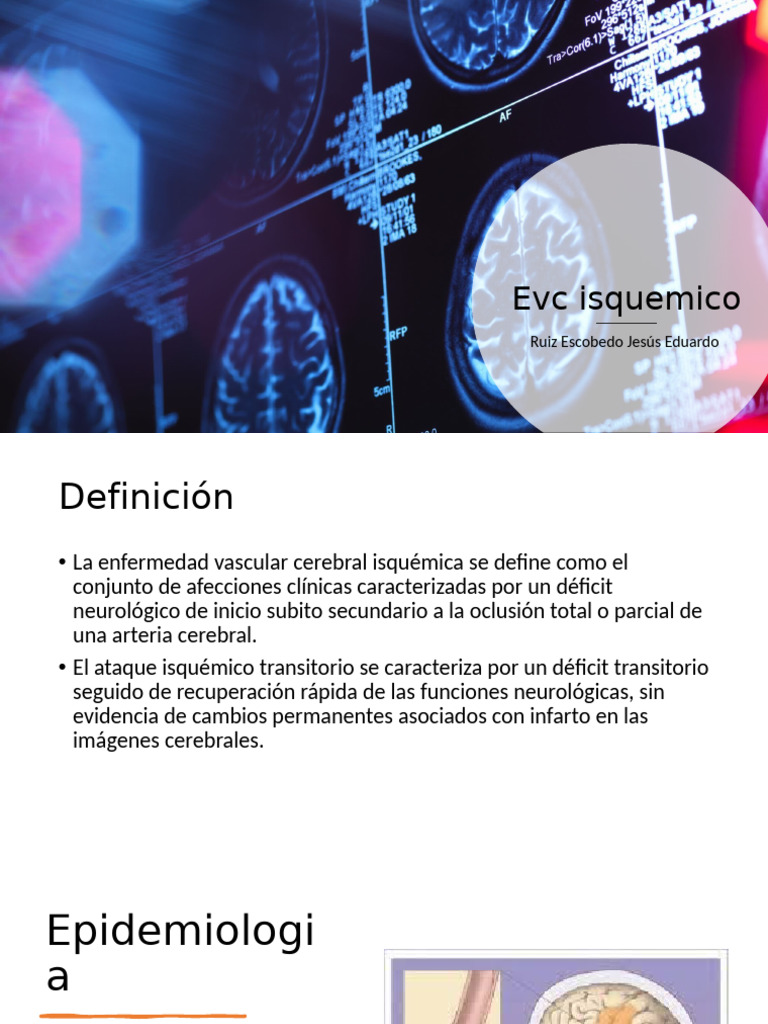 0 - EVC Isquemico Urgencias | PDF | Isquemia | Carrera