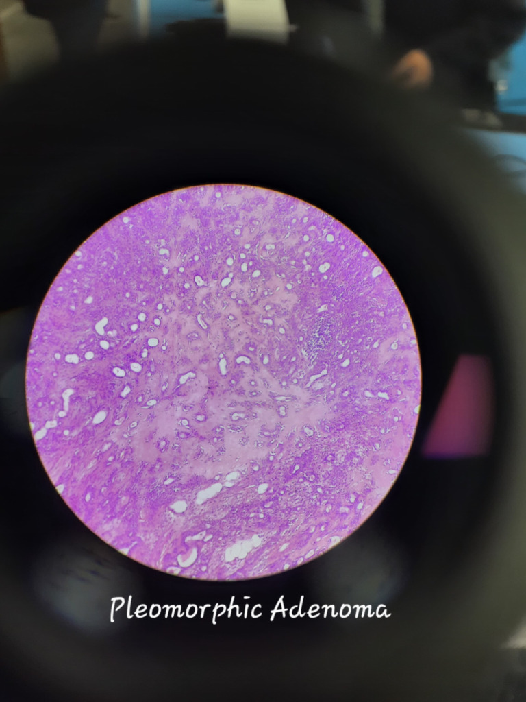 Histo Slides Patho | PDF