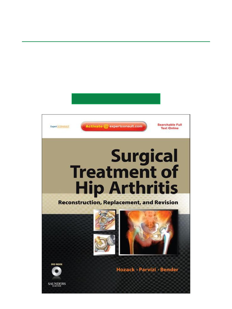 Surgical Treatment of Hip Arthritis Reconstruction, Replacement, and ...
