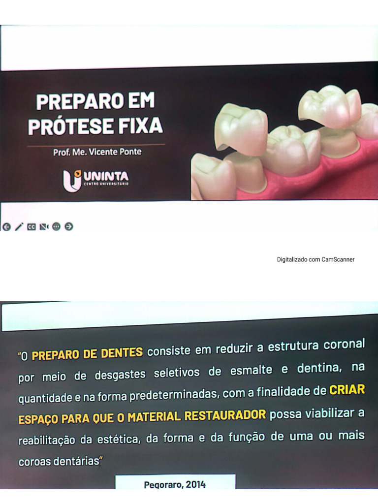 Preparo em Prótese Fixa - Vicente - Reabilitação LL | PDF
