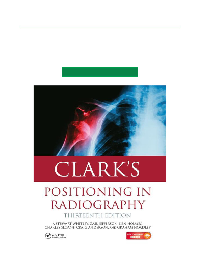 Clark's Positioning in Radiography 13th Edition Free Ebook Download ...