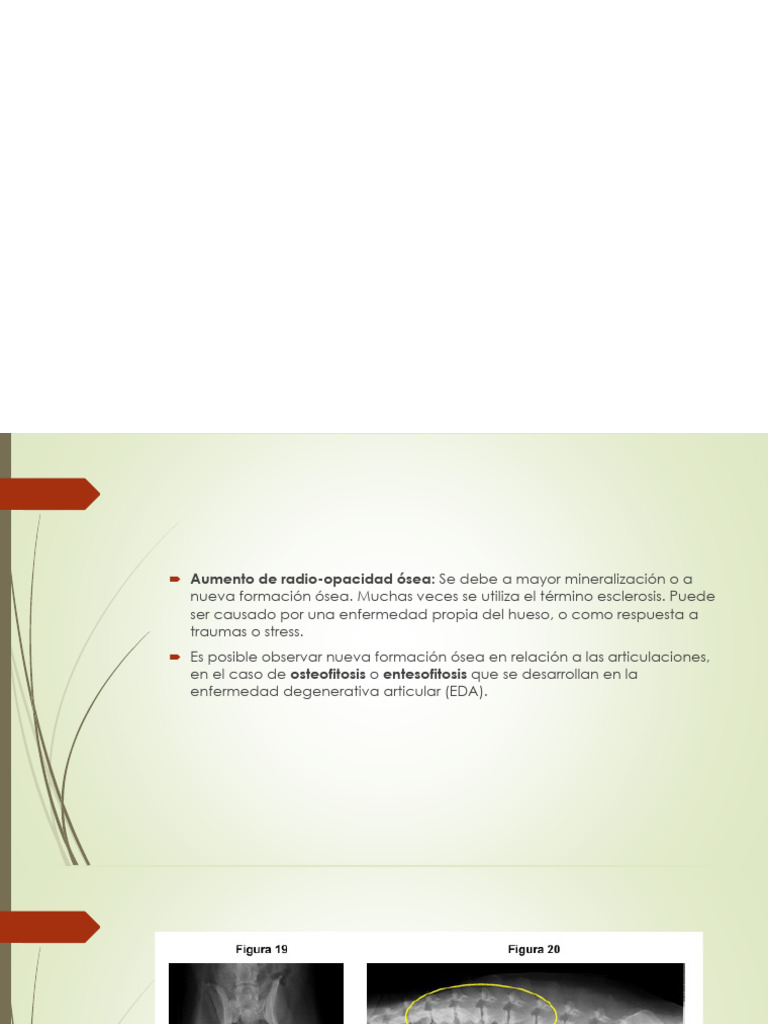 Patrones de Osteogénesis, Osteólisis y Clasificación de Fracturas | PDF ...