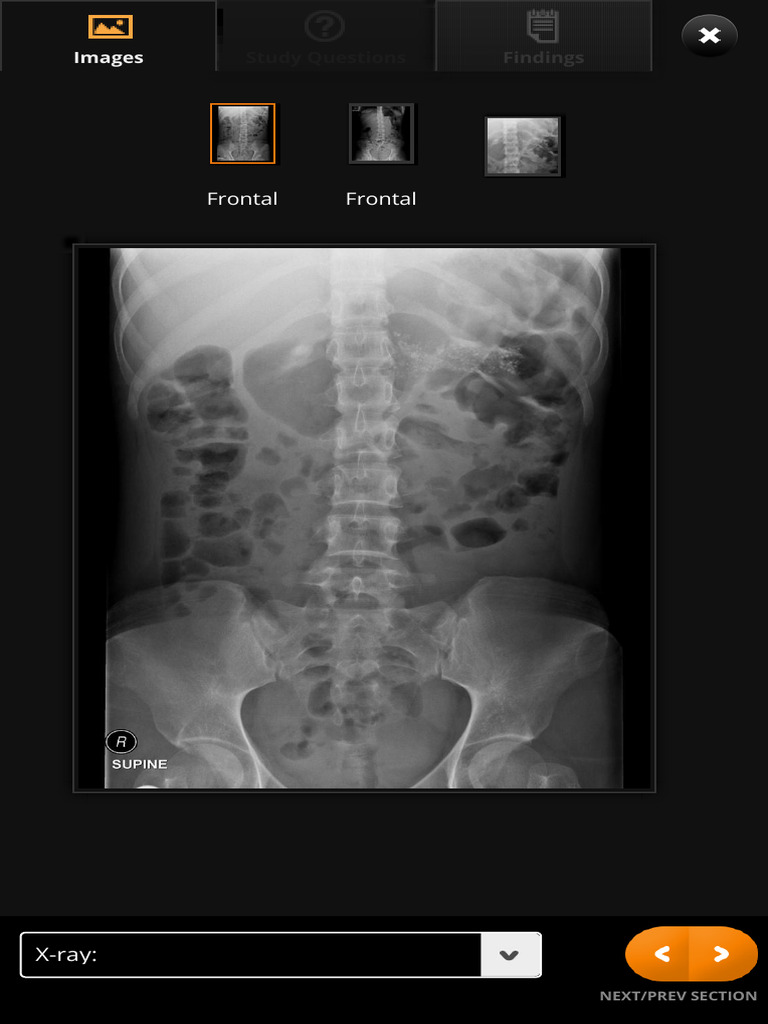 Radiology Quiz 30122 Radiopaedia.org | PDF