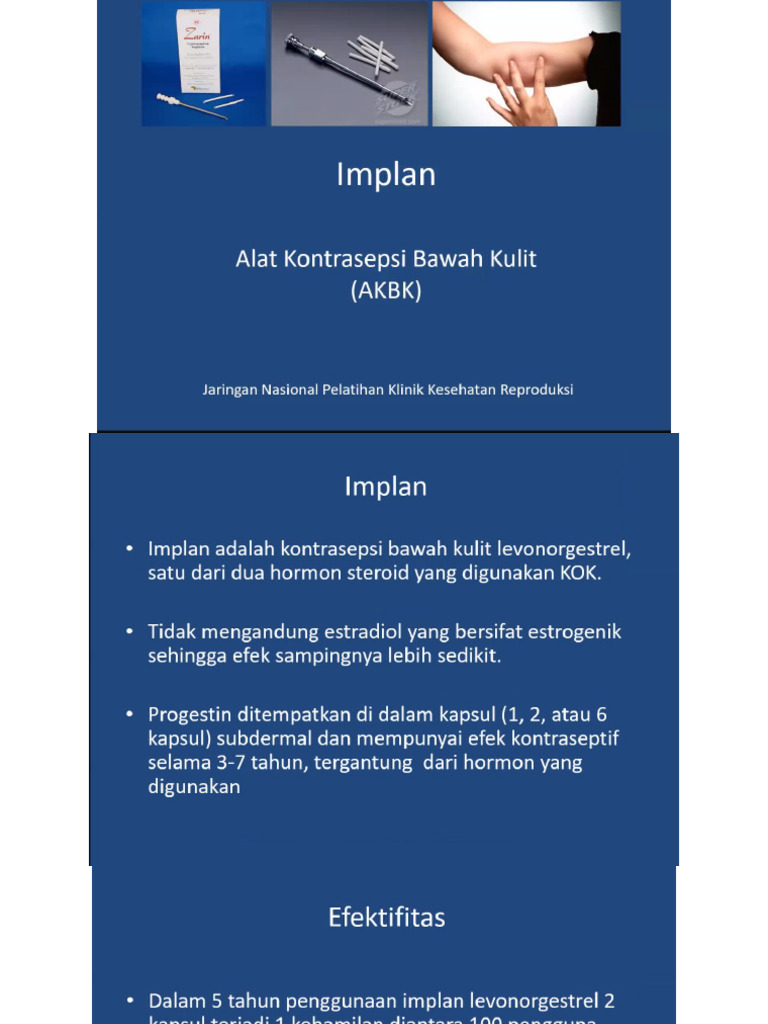 Implan | PDF