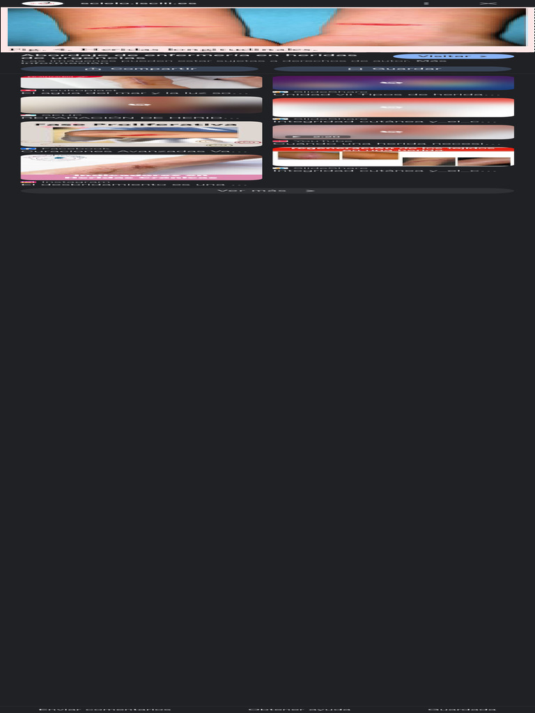 Heridas Profundas Cortadas A Gilet - Buscar Con Google | PDF