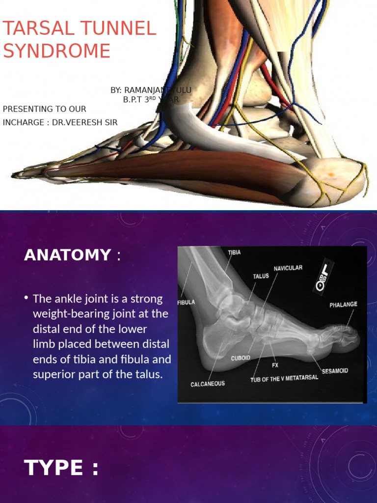 Understanding Tarsal Tunnel Syndrome | PDF | Ankle | Foot