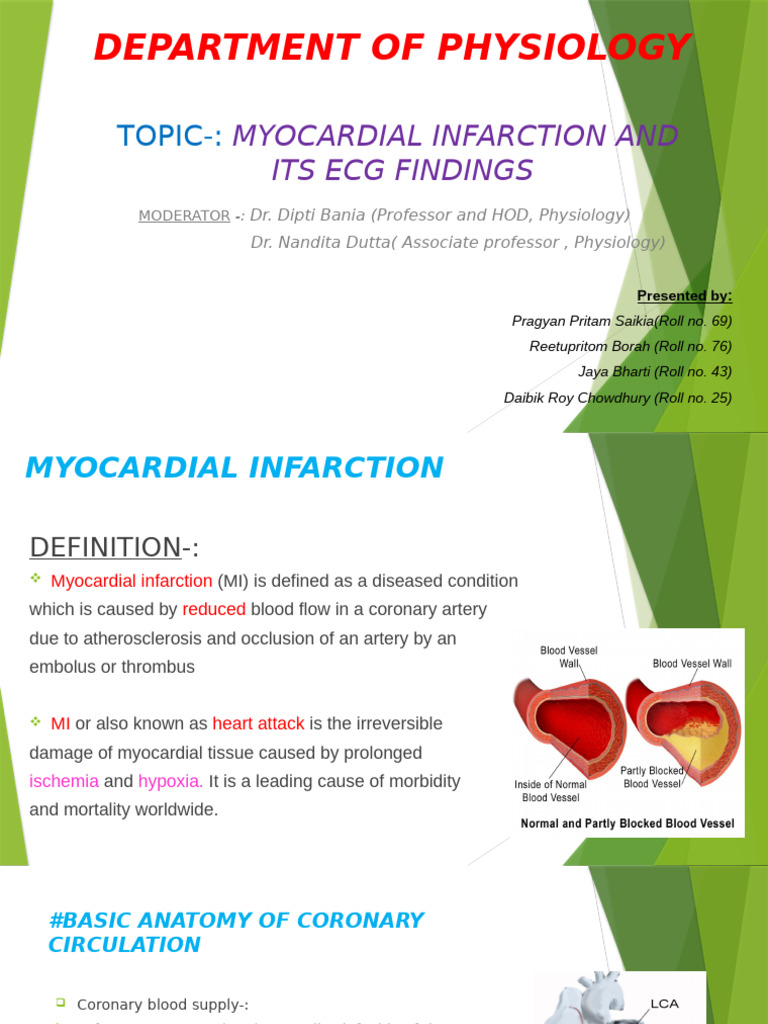 ECG Findings in Myocardial Infarction | PDF | Myocardial Infarction | Heart