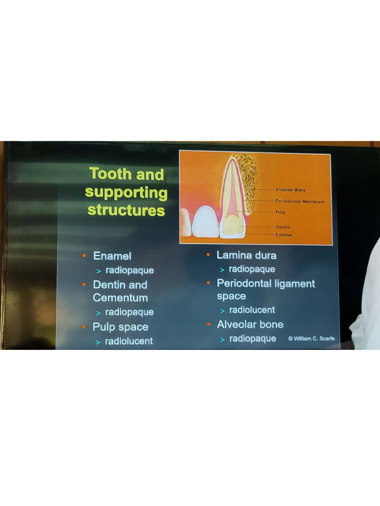 Maxillary Radiographic Anatomical Landmarks | PDF