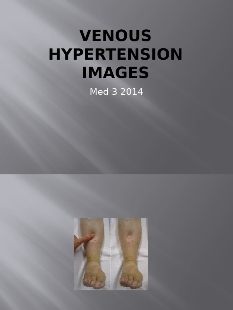 Venous Ulcer Images | PDF
