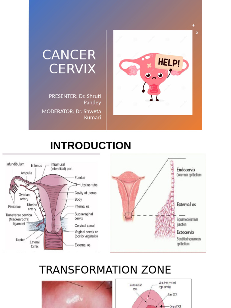 Carcinoma Cervix | PDF | Cervical Cancer | Radiation Therapy