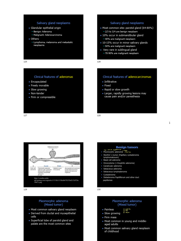 Salivary Gland Lect Handout Part 2 | PDF | Adenoma | Carcinoma