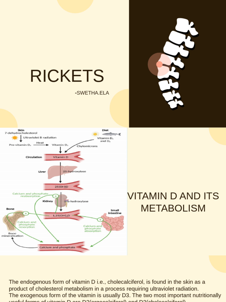 Rickets and Pagets Disease | PDF | Vitamin D | Bone