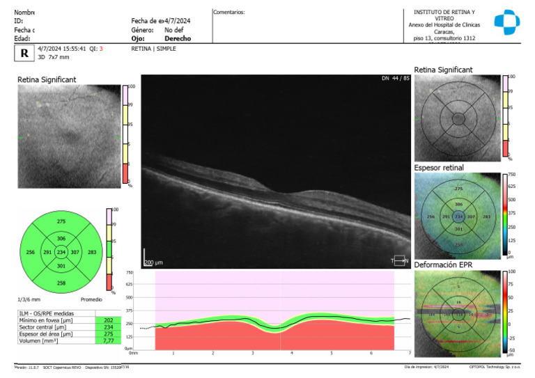 Oct Retina 3D Od | PDF | Visión