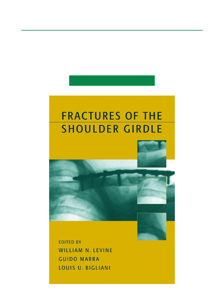 Shoulder Girdle Fractures Guide | PDF | Joints | Shoulder
