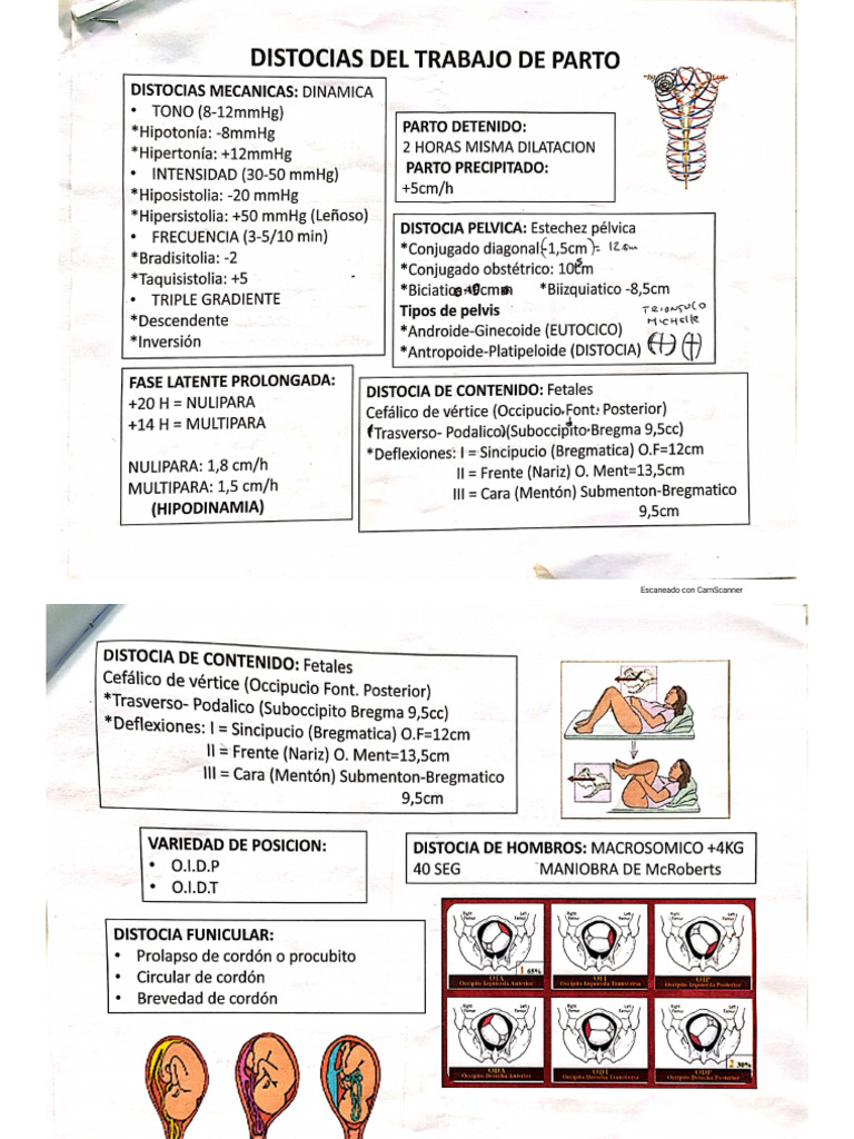 Parto Distocico | PDF