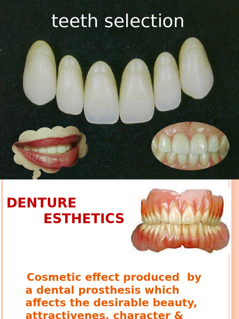 Anterior Teeth Selection | PDF | Tooth | Dentures