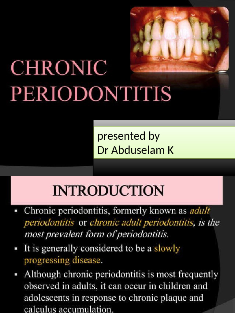 Chronic-Periodontitis - Lecture | PDF
