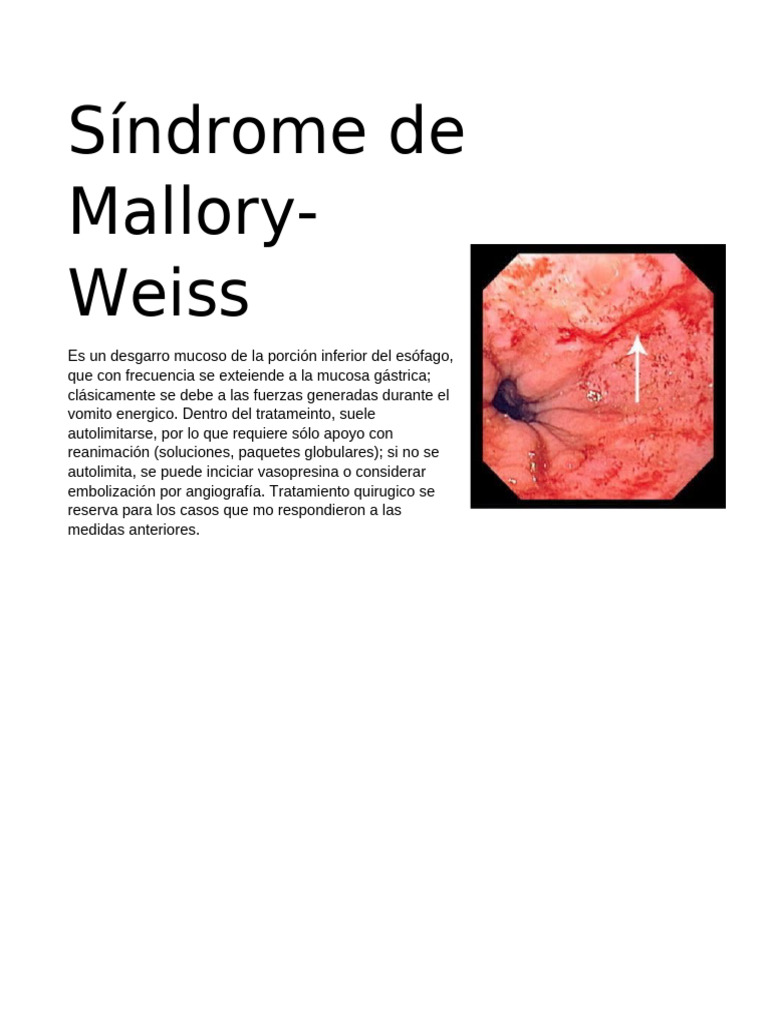 Síndorme de Mallory Weis | PDF