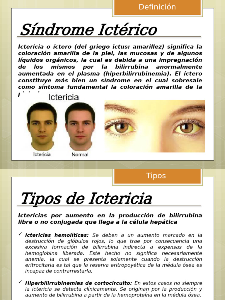 Ictericia | PDF | Bilis | Especialidades Medicas