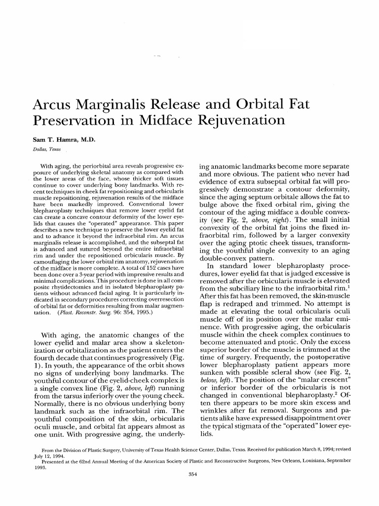 Arcus Marginalis Release and Orbital Fat Pres... | PDF