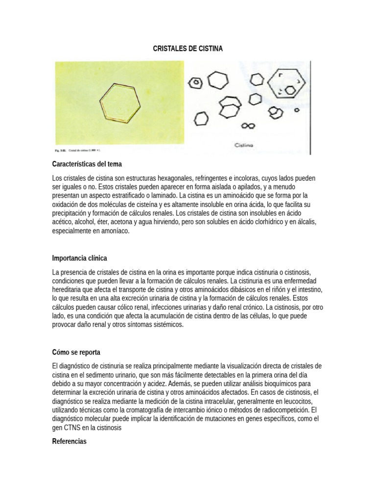Cristales de Cistina en Orina: Diagnóstico y Significado | PDF