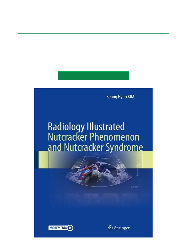 Radiology Illustrated Nutcracker Phenomenon and Nutcracker Syndrome Full MOBI eBook | PDF ...