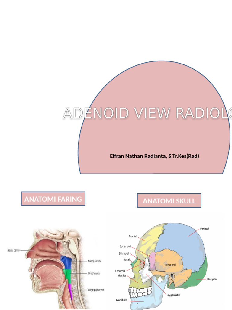 Adenoid View Radiologi | PDF