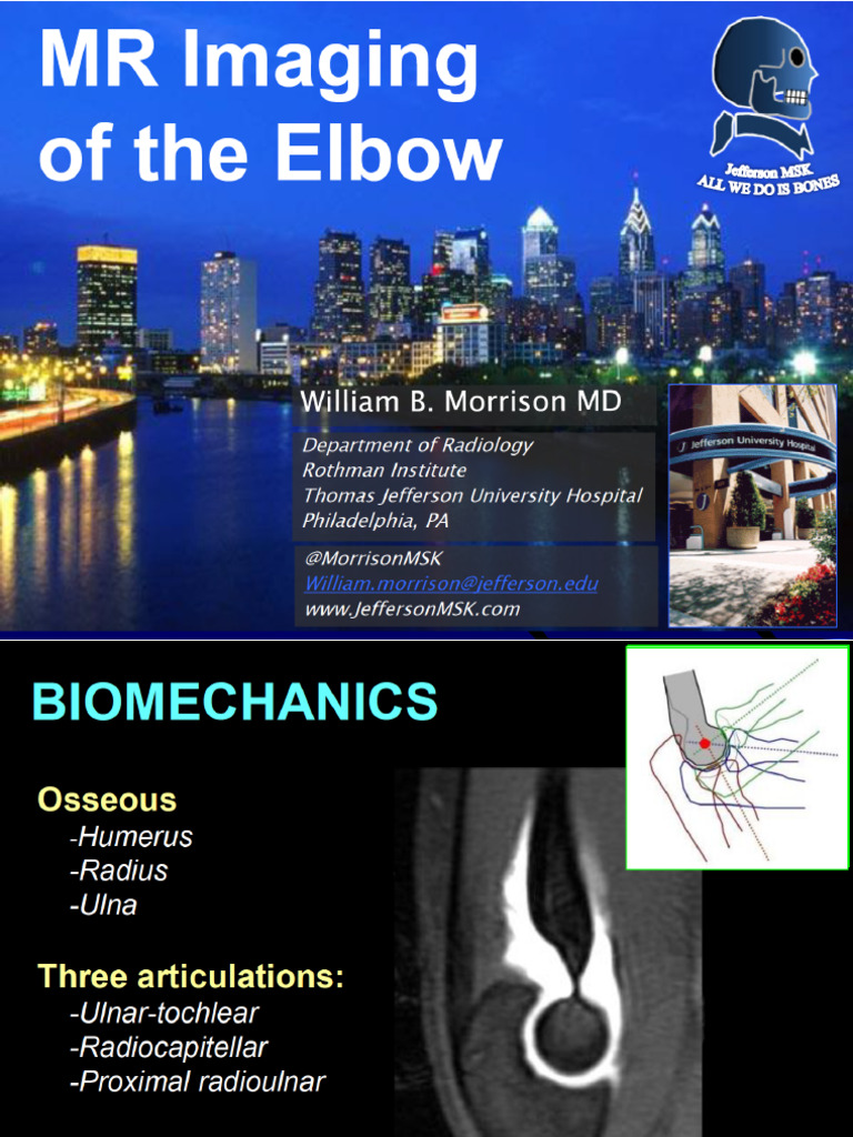 Elbow Injuries: Epicondylitis & Bursitis | PDF | Elbow | Human Anatomy