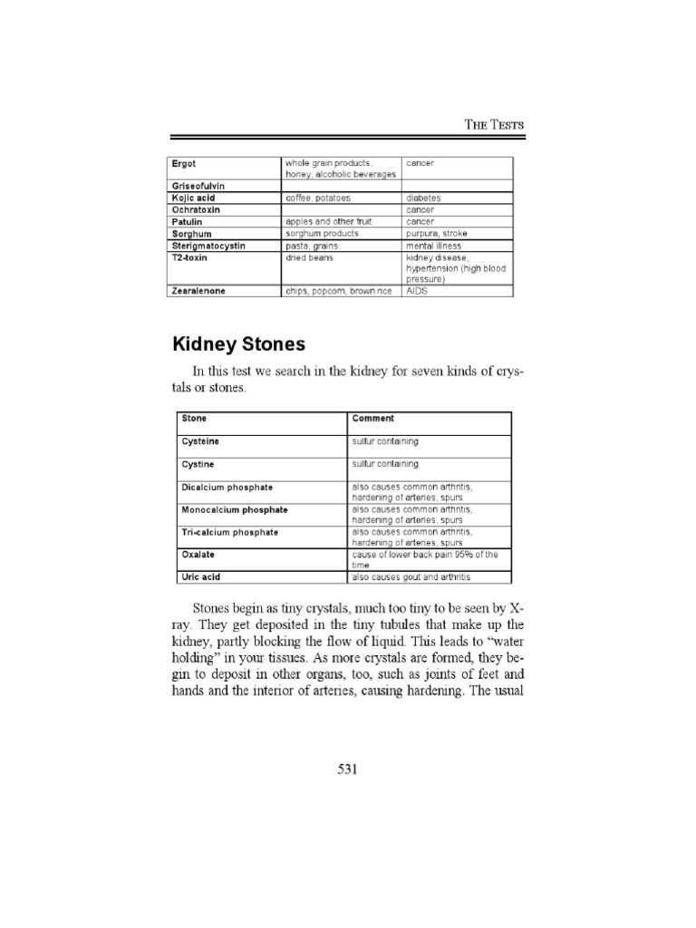 Kidney Stones | PDF