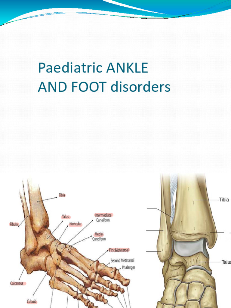 Lecture 7 (Pediatrics Ankle and Foot) | PDF | Foot | Ankle