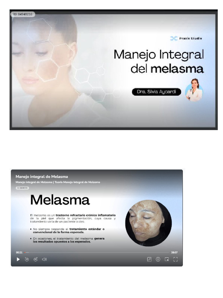 DIAPOSITTIVAS_manejo integral del melasma | PDF