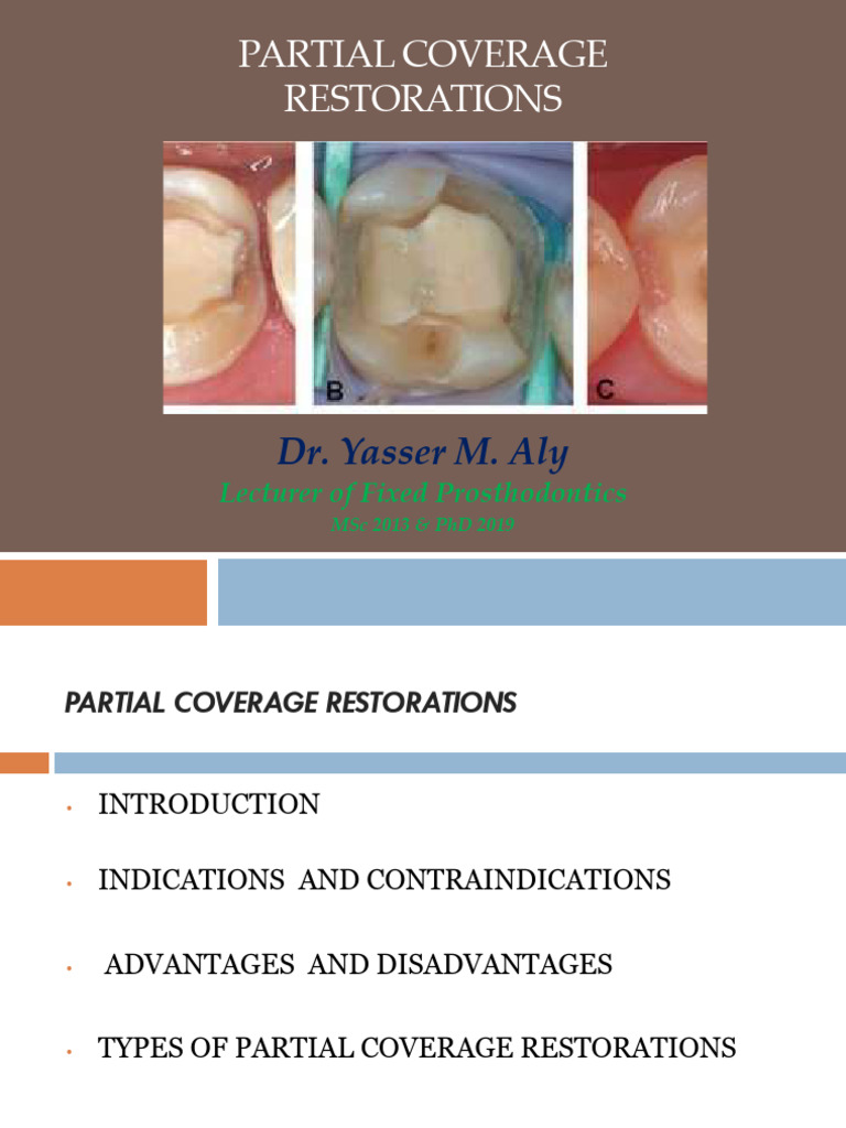 Fixed 7 - Partial Coverage | PDF | Dentistry Branches | Dentistry