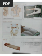 Gallows Traction Fact Sheet | PDF