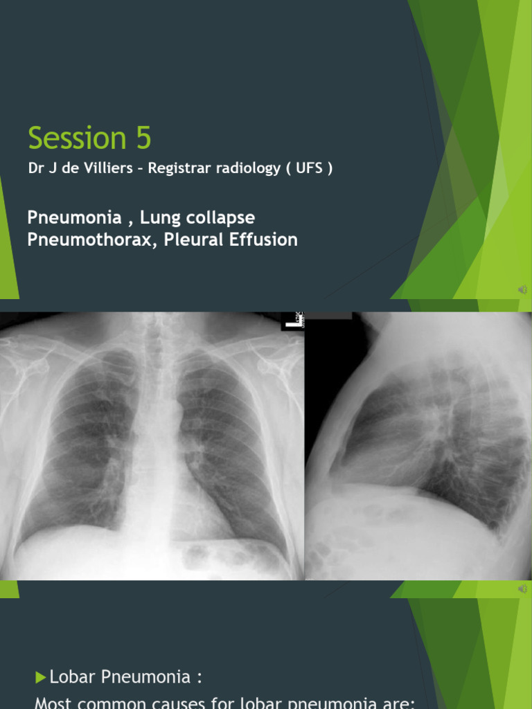 5. Pneumothorax, pleural effusion, collapse(1) | PDF | Pneumonia | Lung