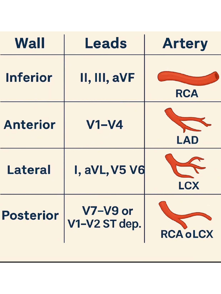 Mi Arterial Occlusion | PDF