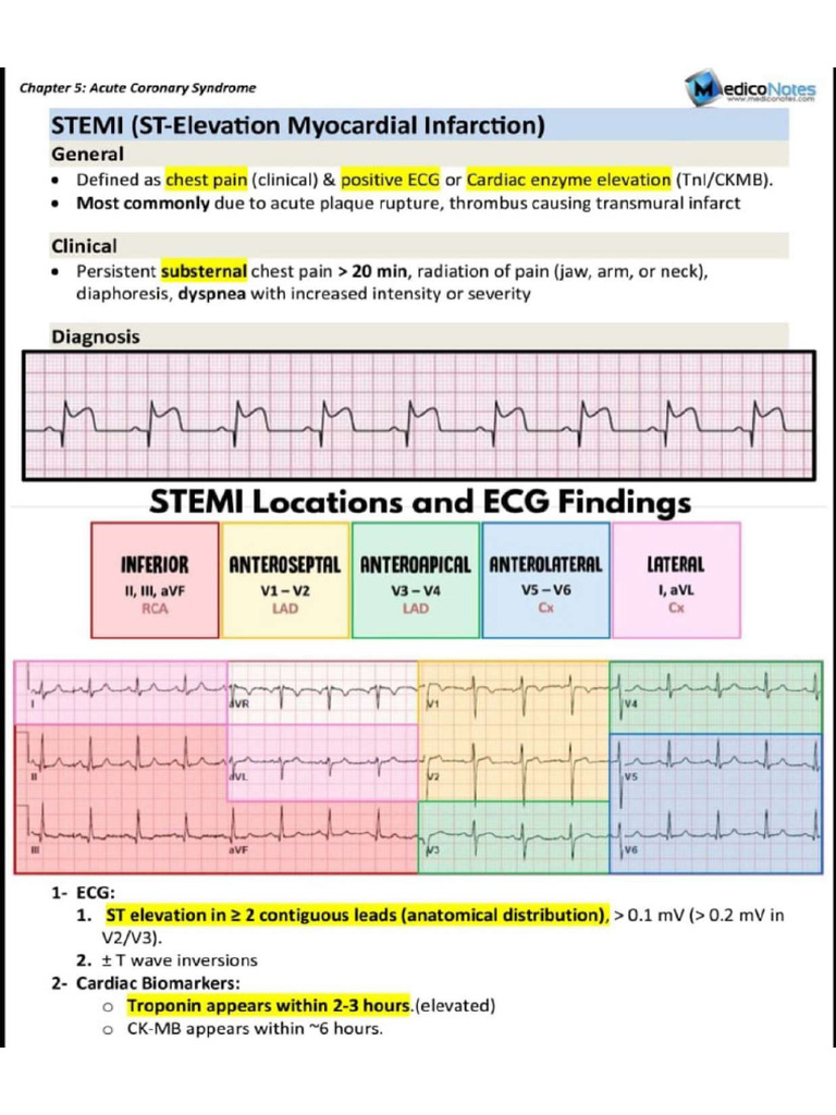 STEMI | PDF