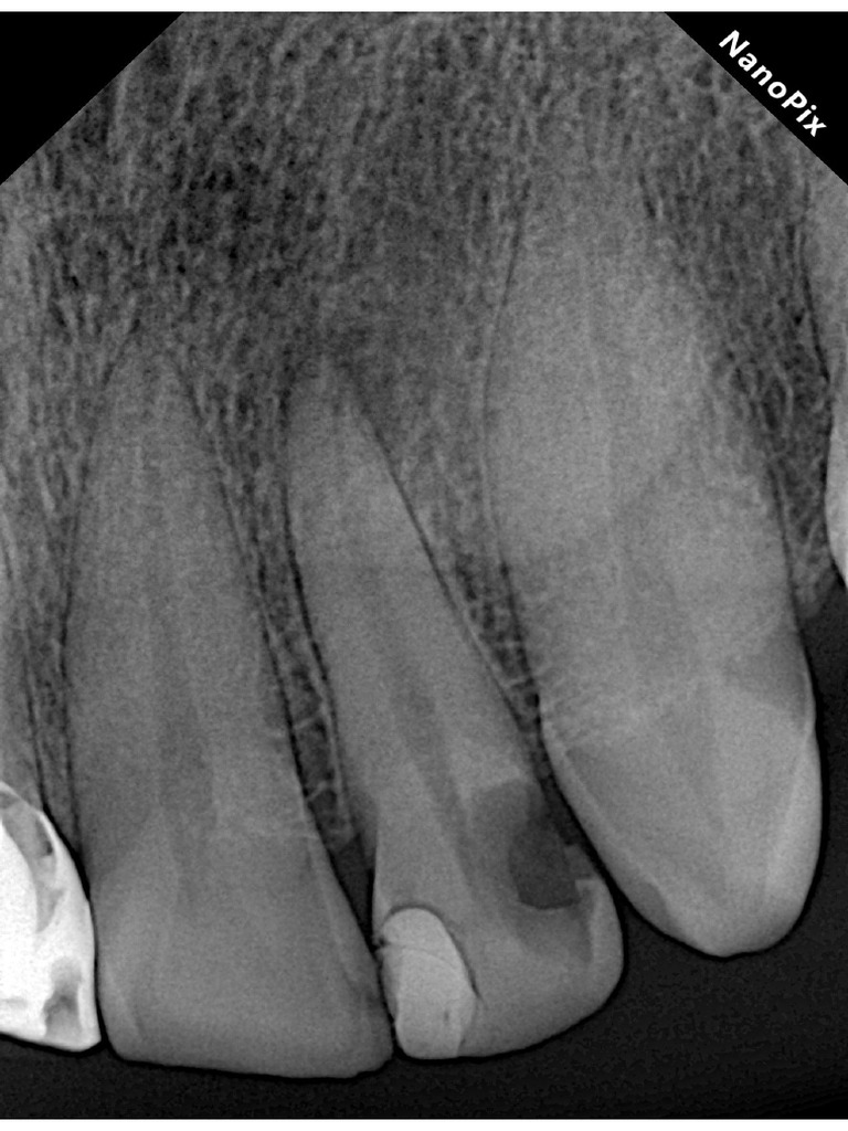 PDFReader 20250404 1658 | PDF