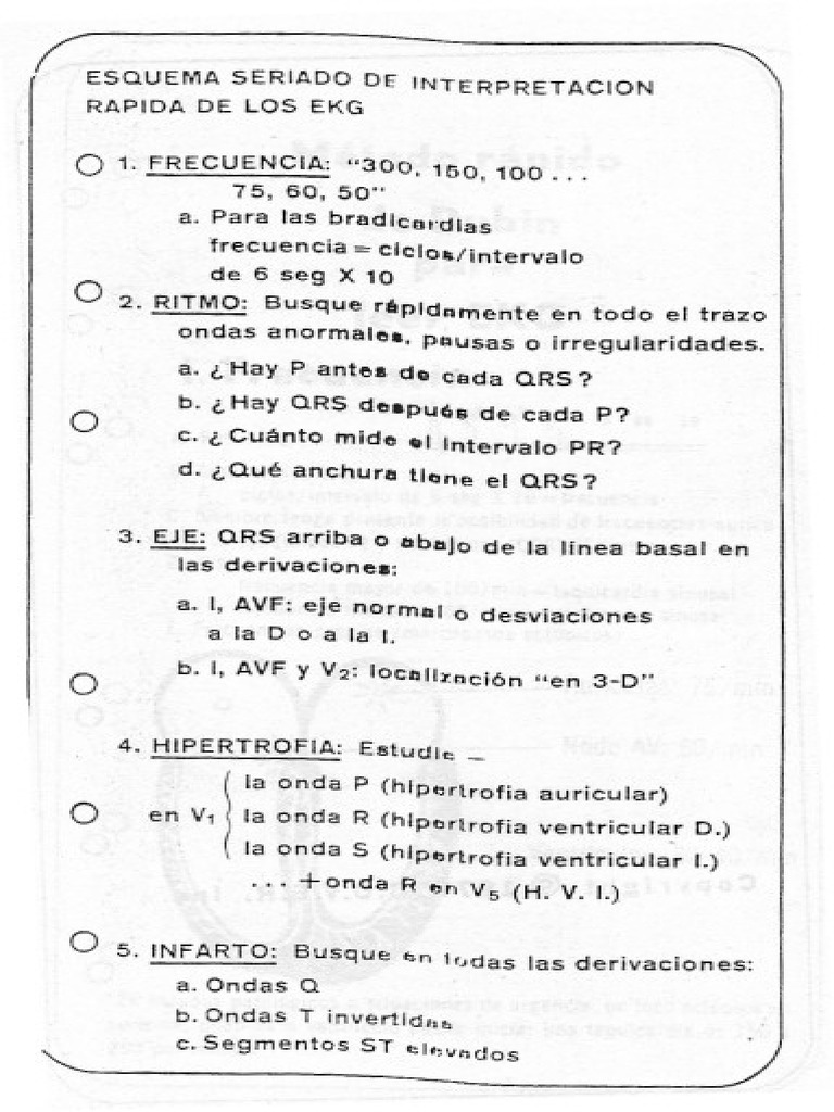 Esquema Interpretacion ECG Dubin Rapido | PDF